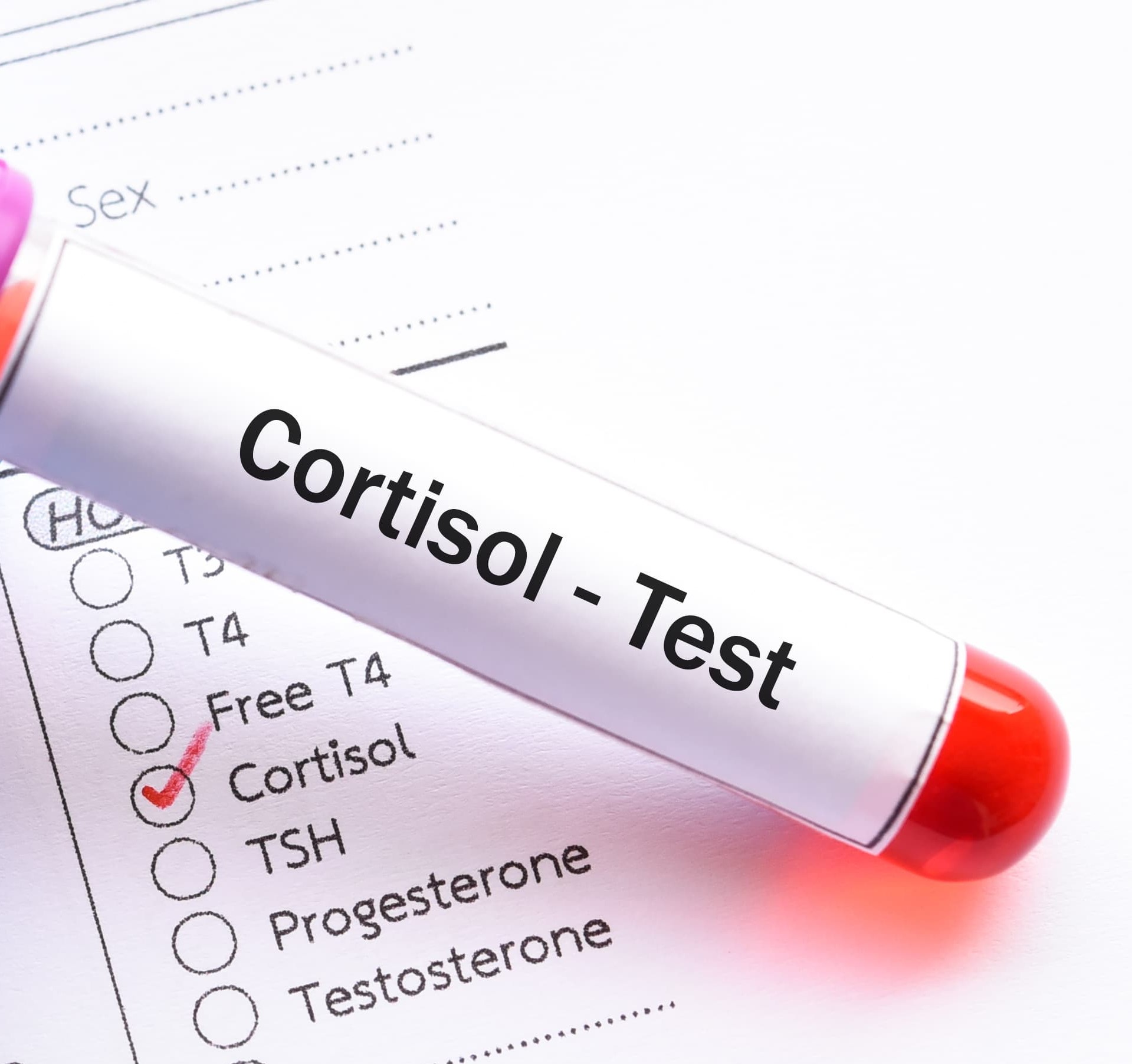 Todo sobre el cortisol